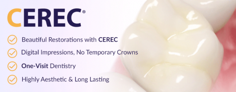 What You Need to Know About CEREC Dental Crowns - Smile Makeover of LA